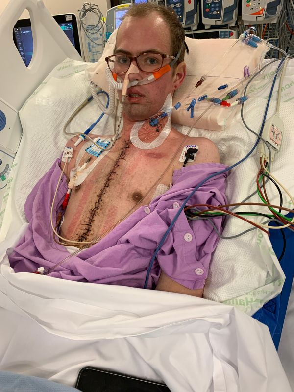 Rhys Hoole: The Prince Charles Hospital's 500th Heart Transplant ...